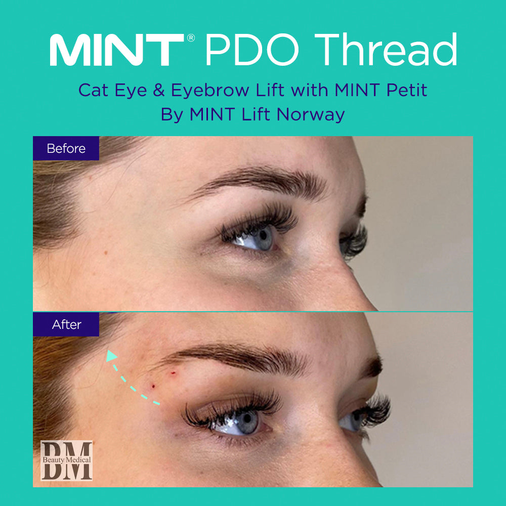 Cat Eye Treatment - MINT™ PDO & Klàrdie Manufacturer – MINT™ PDO ...