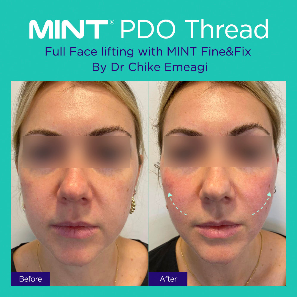 Face Treatment - MINT™ PDO & Klàrdie Manufacturer – MINT™ PDO & Klárdie ...